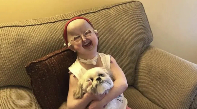 Baby Born With Unusual Syndrome – 22 Years Later She Looks Amazing