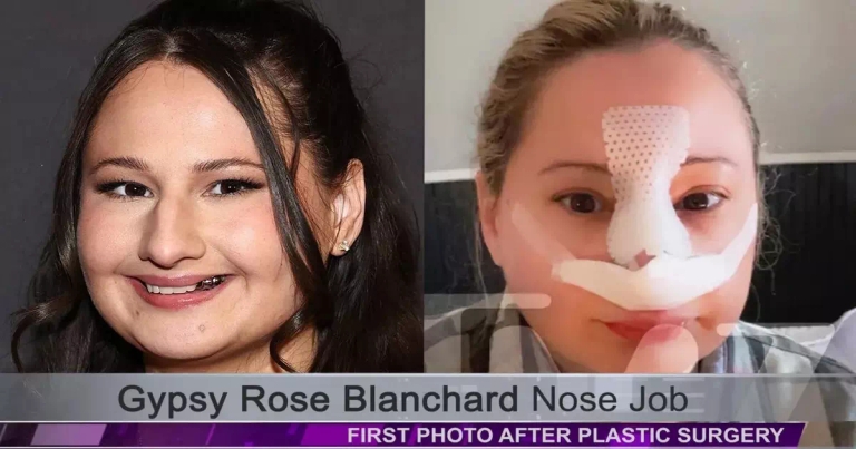 Gypsy Rose Blanchard Unveils New Look After Surgery